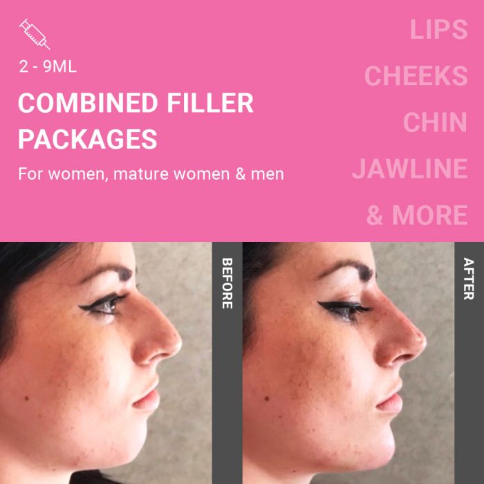 Save Up To 35% - Combined Filler Packages - Heart Aesthetics